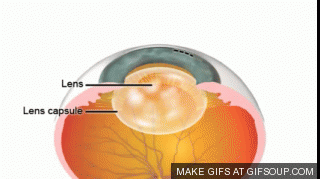 CATARACT: November 2010