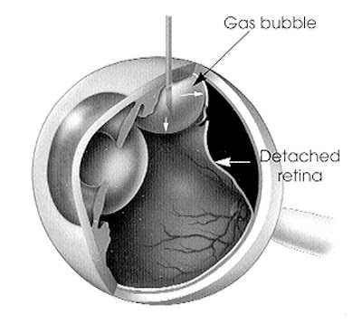 Eye Yi Eye: The Gas Bubble is Expanding Fast ~ Friday, July 10th, 2009 ...