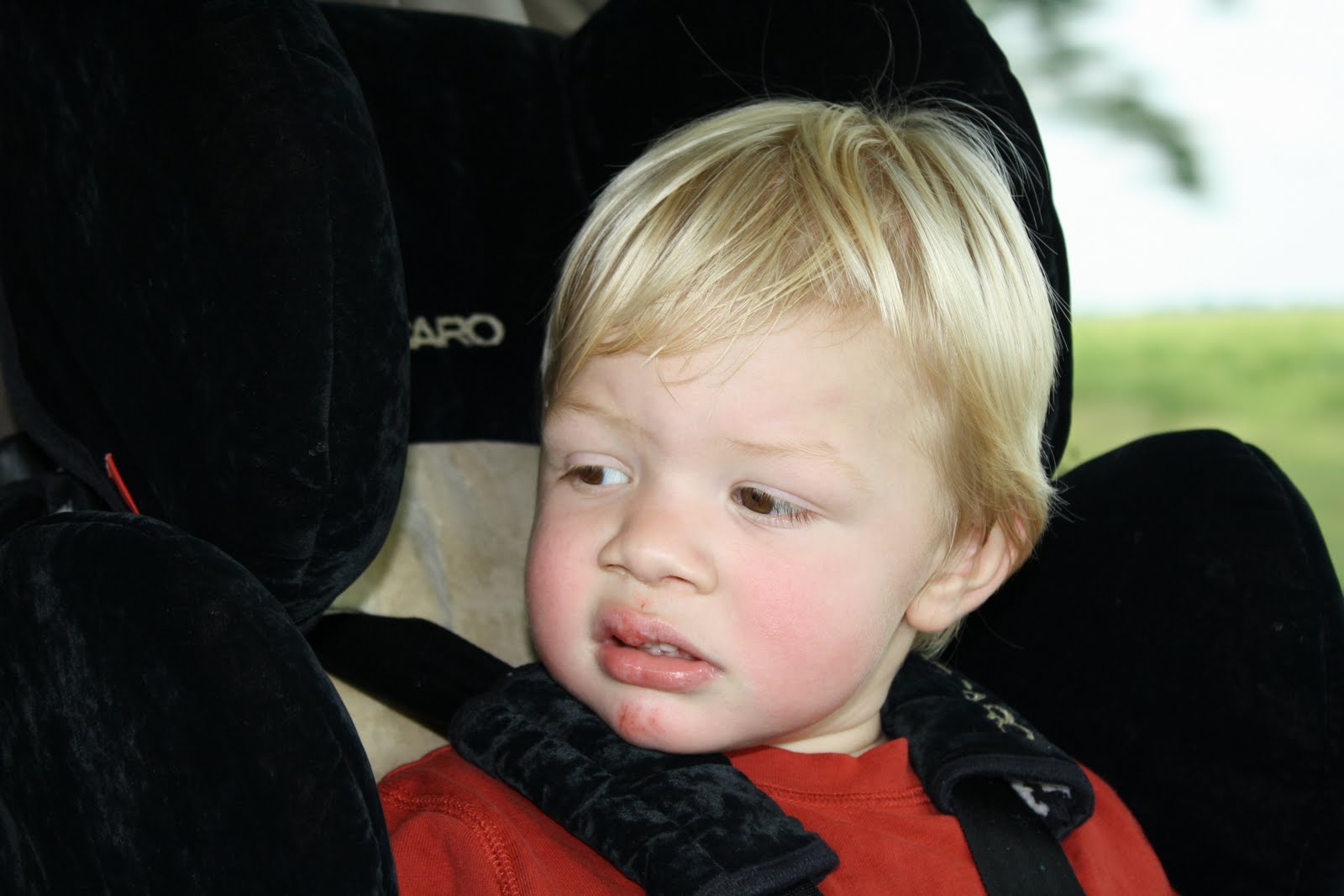 Jacob365: Jacob's Fat Lip...Poor Baby