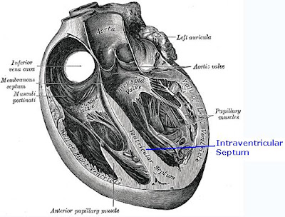 Science, Natural Phenomena & Medicine: Intraventricular Septum