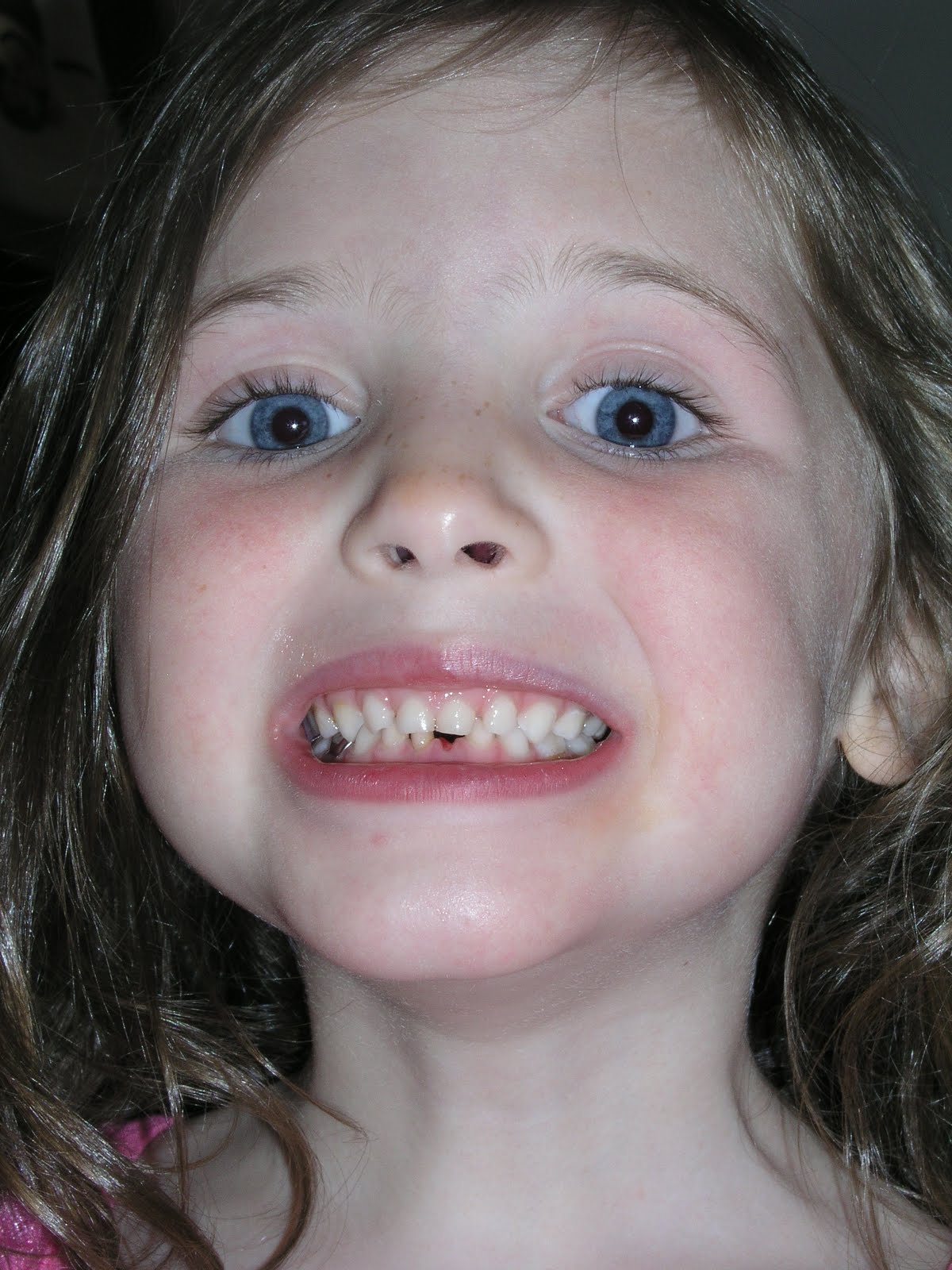 The Gunter's: Winni the toothless Wonder!