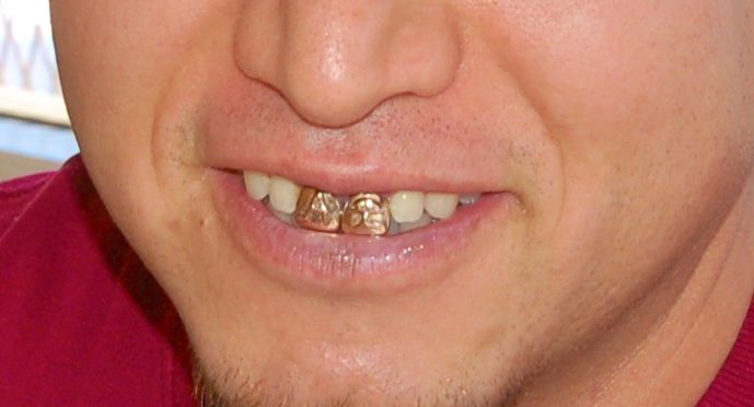 "Off the Eatin' Path with Monte": The man with the "Gold Teeth" will ...