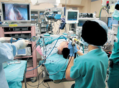 MAKANAN SEIMBANG: TANDA TANDA PENYAKIT KENSER PERUT / KENSER PERUT ...