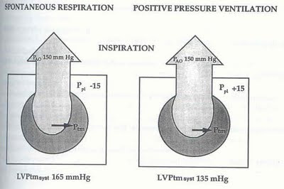 Pedi cardiology: ICU: Cardiopulmonary Interaction - Spontaneous ...
