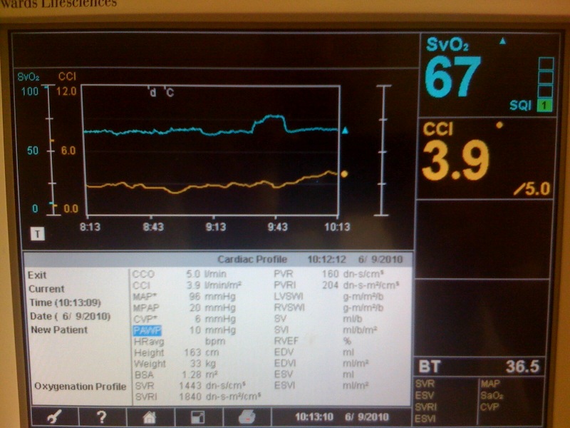 Pedi cardiology: ICU: Swan data display