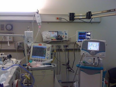 Pedi cardiology: ICU: Monitor - s/p Norwood - Temporary pacemaker ...