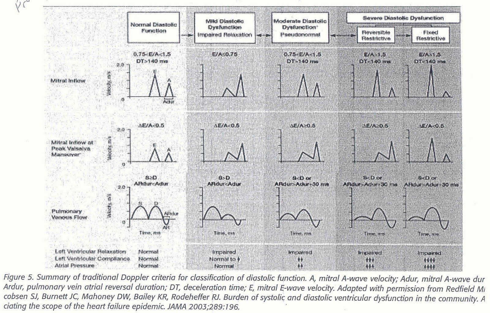 Pedi cardiology: Echo: Doppler flow patterns to assess diastolic function