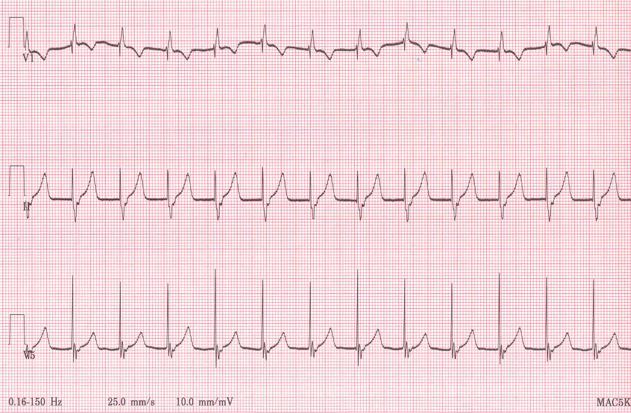 Pedi cardiology: EKG: Interpret this...