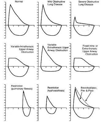 Phimaimedicine: 6. Flow-volume curve/Obstruction