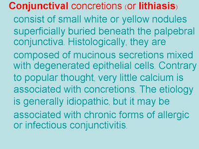 Phimaimedicine: 99. Conjunctival concretions/ lithiasis
