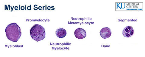 Phimaimedicine: 618. Chronic myeloid leukemia (CML)