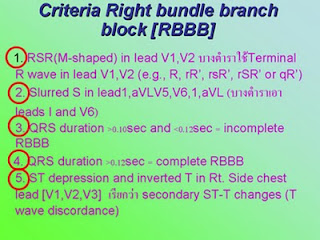 Phimaimedicine: 777. Atrial fibrillation and complete right bundle ...