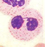 A Synthetic Environment: Pelger-Huët, pince-nez and the Top 5 pince-nez ...