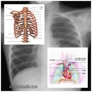 Rayos 2011: Tórax Oseo