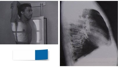 Rayos 2011: Tórax - Proyecciones