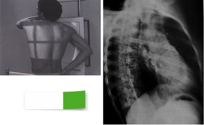 Rayos 2011: Tórax - Proyecciones