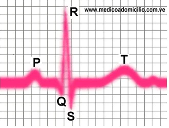 Electrocardiograma Normal Corazon: Electrocardiograma
