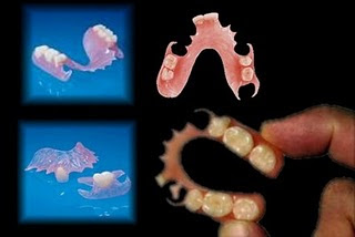 CLINICA DENTAL VALENCIA: * PROTESIS TOTALES Y PARCIALES