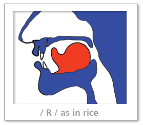 RhoRacism Corridge (Rhotacism Cottage)