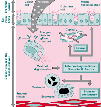 PBL Group A Website: Pathophysiology+signs and symptoms of asthma