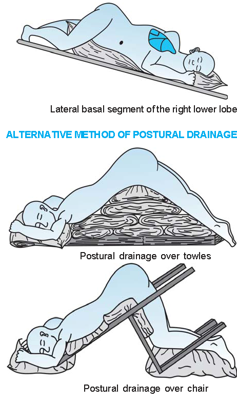 Physioteach: POSTURAL DRAINAGE POSTIONS