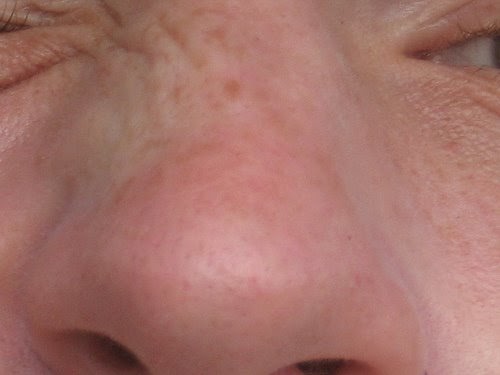 Sangrado de nariz ~ Solountip.com