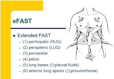 jack119.org: 急診外傷超音波檢查：FAST