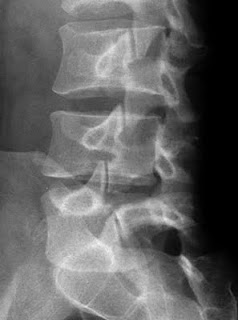 record of pieta: Scotty dog sign