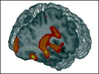 voo rasante: Cérebro do pedófilo