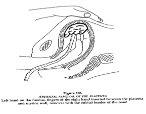 undergrad RN: November 2010