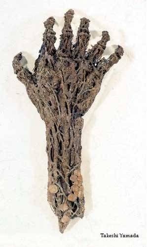 Caliban's Revenge: Alien Hand Syndrome?