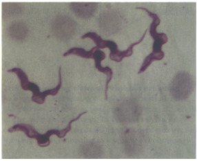 Introduction to Medical Parasitology: African Trypanosomiasis