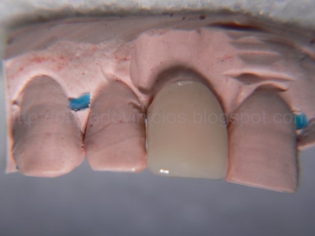 Dr Marlo Vinicios Duarte Lemos - Cirurgião Dentista - Odontologia ...