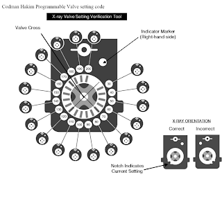 Utah Pediatric Radiology: Codman Hakim programmable shunt valve ...