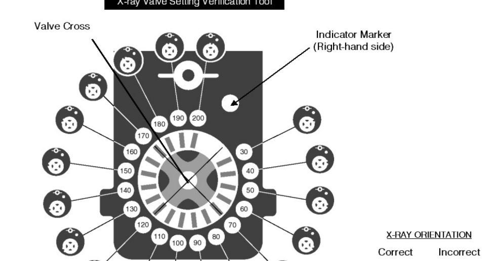 Utah Pediatric Radiology: Codman Hakim programmable shunt valve ...