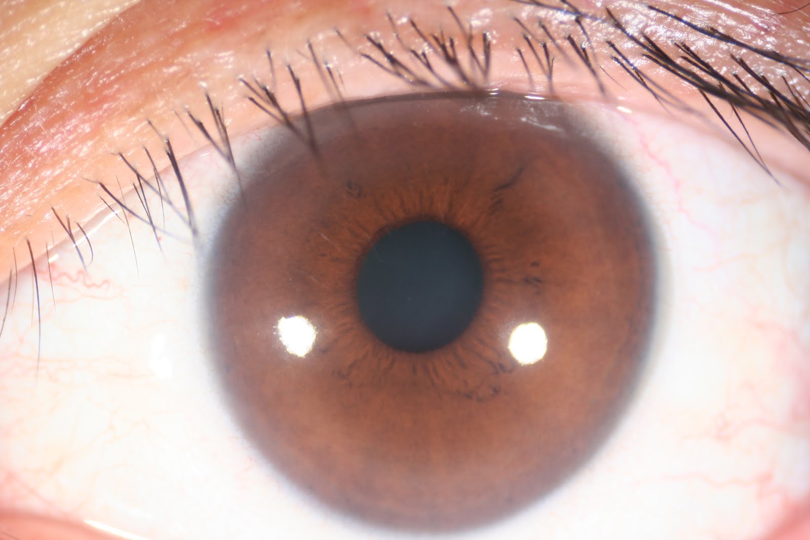 Modern & Multidimensional Iridology: Iridology + Sclerology Analysis