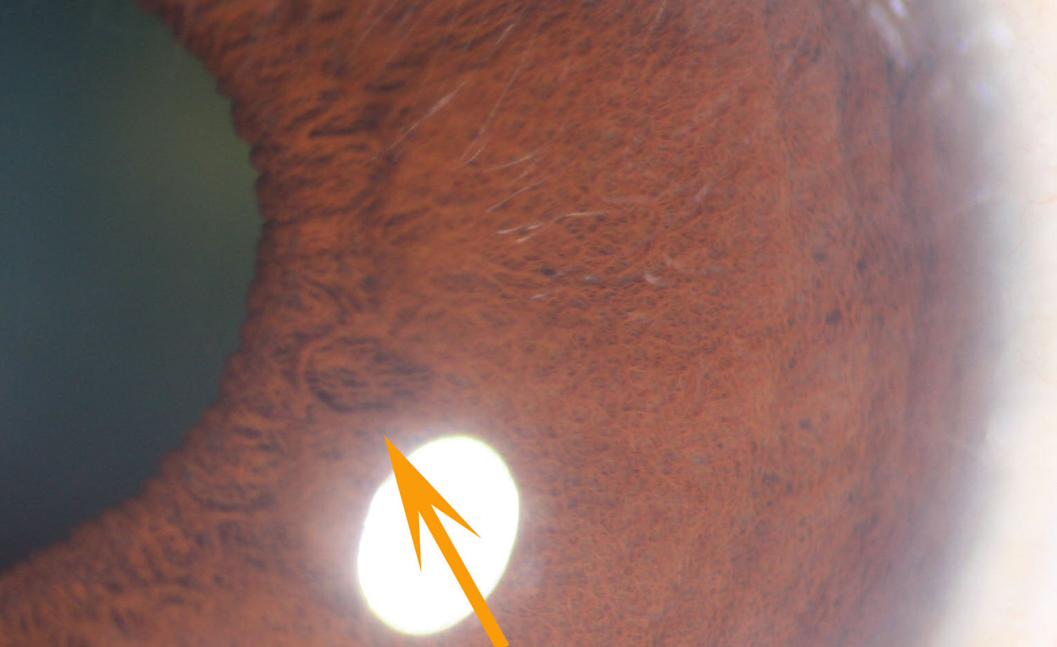 Modern & Multidimensional Iridology: Iridology Analysis - 44