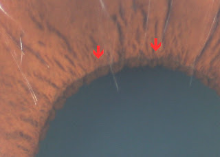 Modern & Multidimensional Iridology: iris- 4