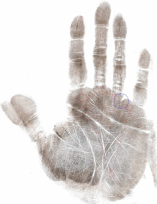 Modern & Multidimensional Iridology: Dermatoglyphics - Finger Print ...