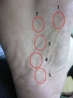 Modern & Multidimensional Iridology: Foot Glyphology Analysis- 40 ...