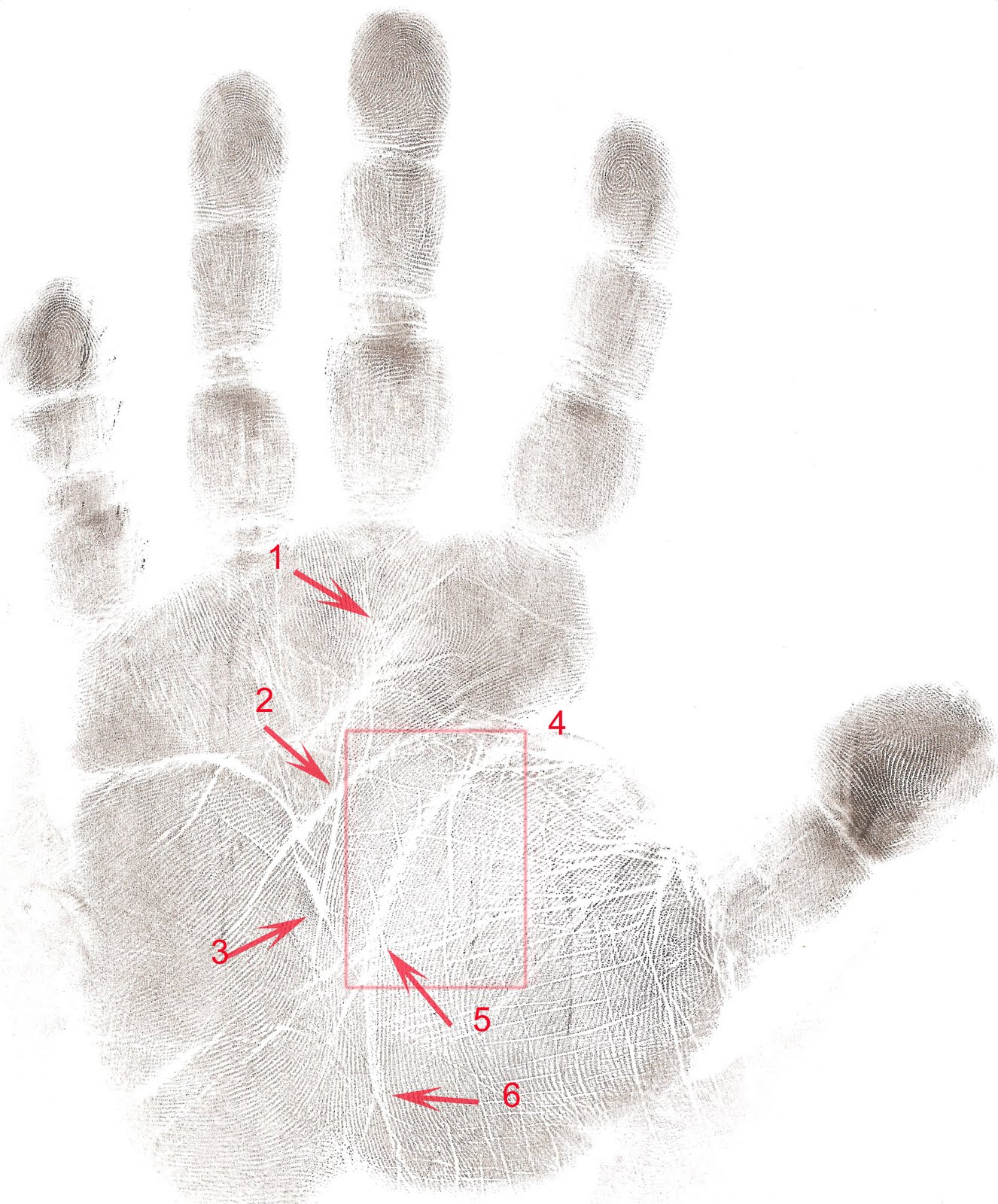 Modern & Multidimensional Iridology: Medical Palmistry Analysis