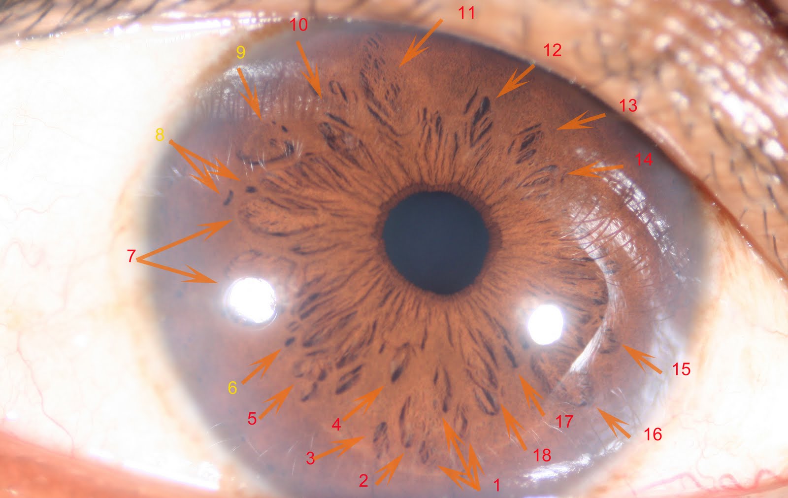 Modern & Multidimensional Iridology: Multidimensional Iridology ...