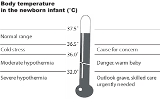 Pediatrics: Cut offs for Hypothermia in a Newborn