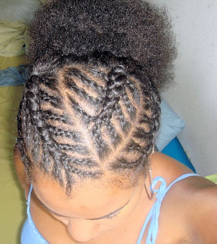 Keep It Kinky: Natural Hair and Beauty: No Flakes Here – How to Treat ...