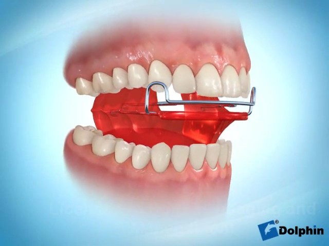 doctors videos backup: Dentistry: Bionator [HQ]