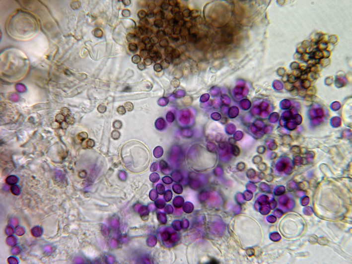 Fun With Microbiology (What's Buggin' You?): Aspergillus nidulans ...