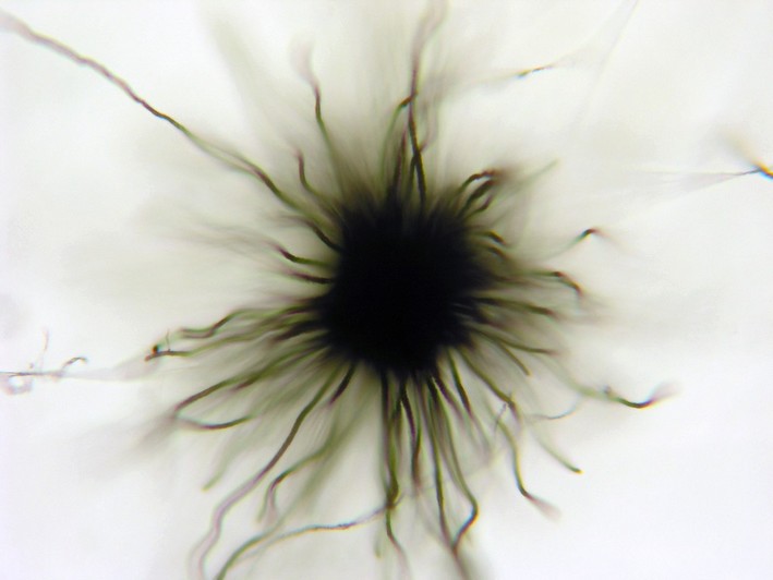 Fun With Microbiology (What's Buggin' You?): Chaetomium Species