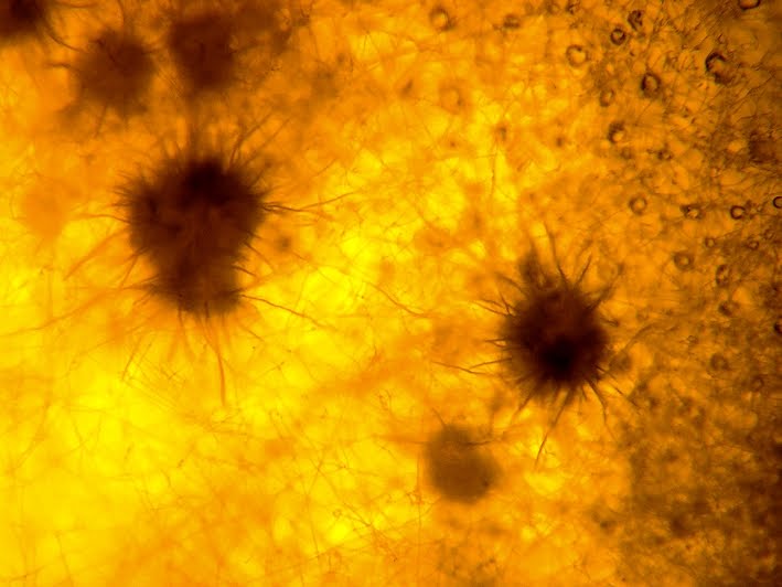 Fun With Microbiology (What's Buggin' You?): Chaetomium Species