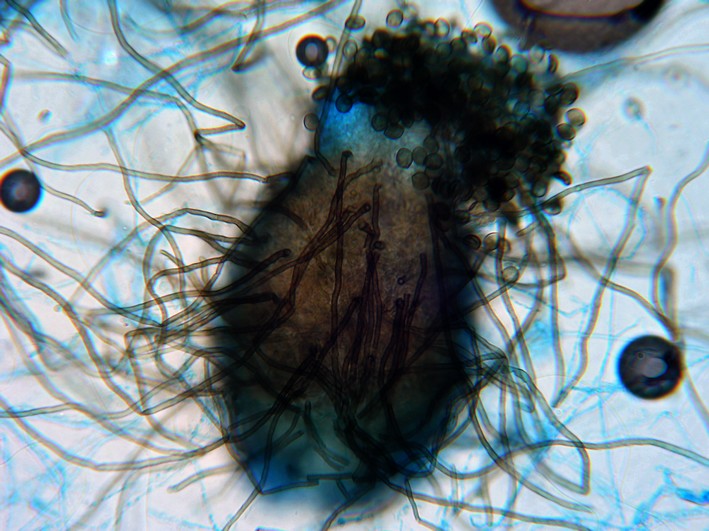 Fun With Microbiology (What's Buggin' You?): Chaetomium Species