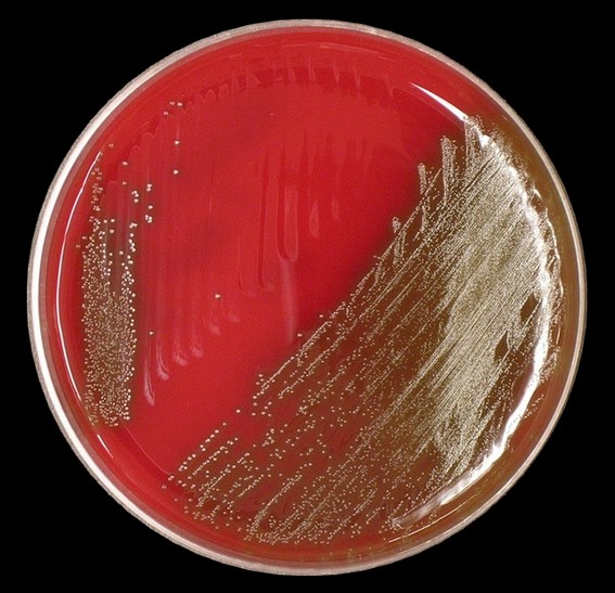 Fun With Microbiology Whats Buggin You Streptococcus Anginosus Group